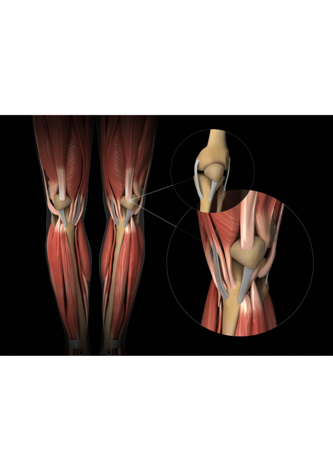 Hoe zit het kniegewricht in elkaar? Lees hier over de anatomie van de ...